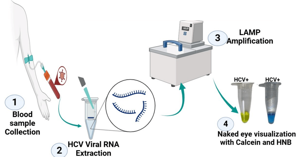 Bridging the Diagnostic Gap: A Rapid, Cost-Effective, and Equitable ...