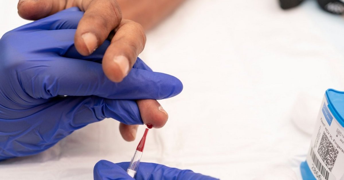 Diagnostic Accuracy of Point-of-Care HCV Viral Load Assays for HCV ...